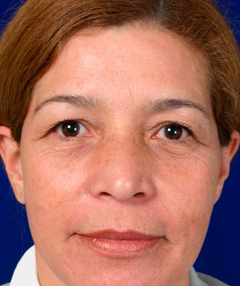 Casos – Dr. Juan Manuel Laverde